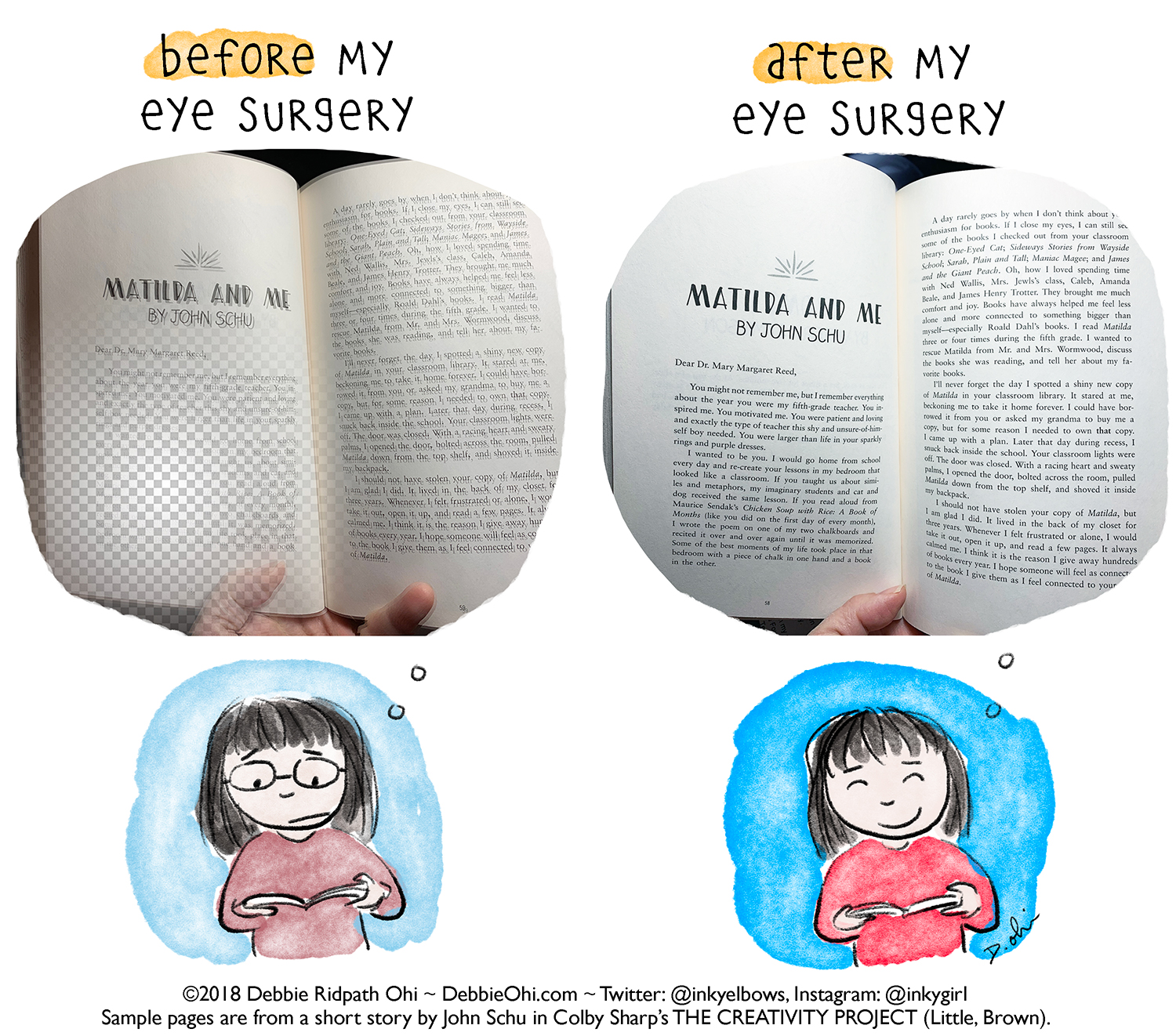 I CAN SEE! Igor, double eye surgery and seeing the world with new eyes ...